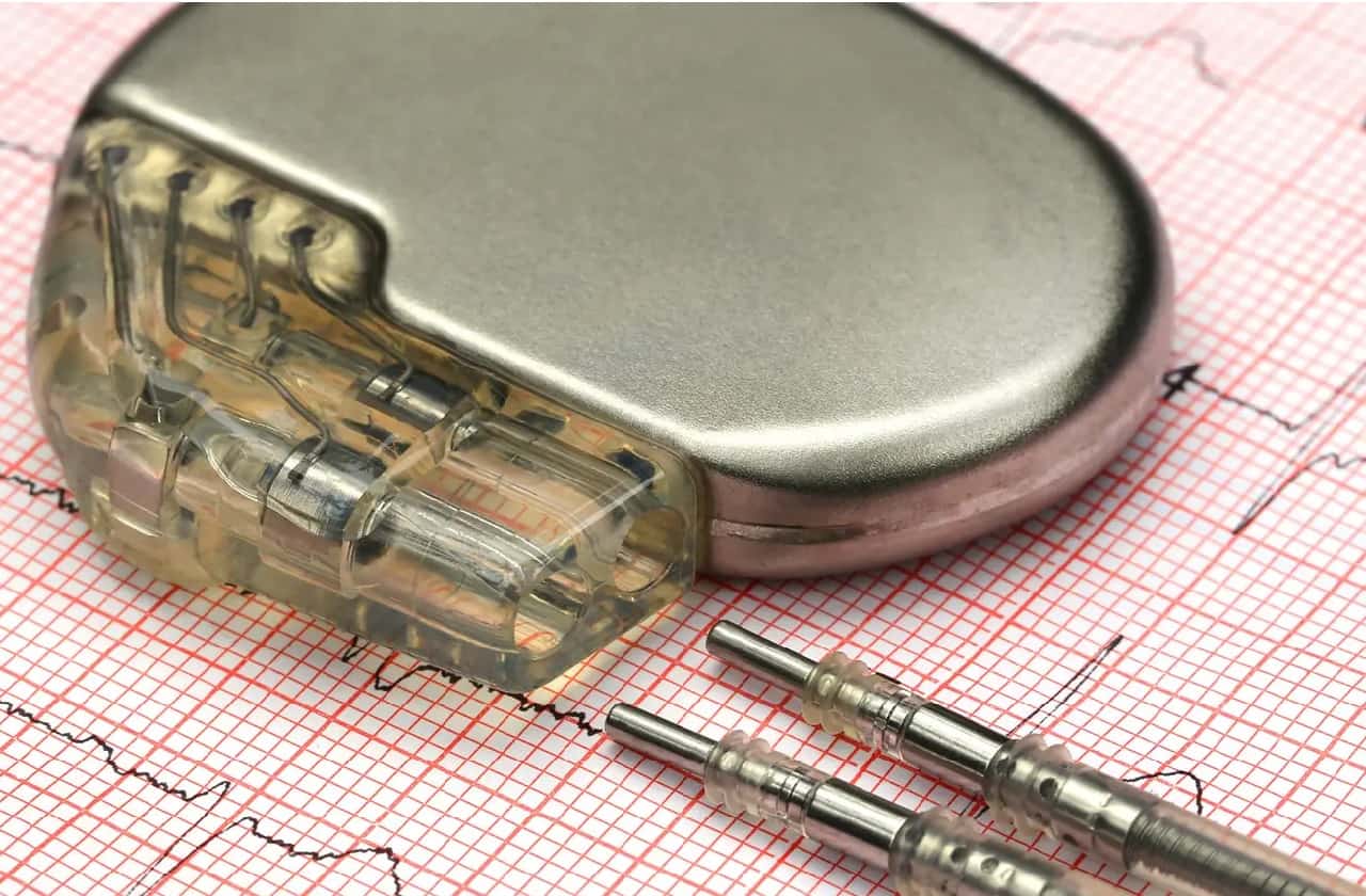 Hamilton researchers show new cardiac defibrillator is safer for ...